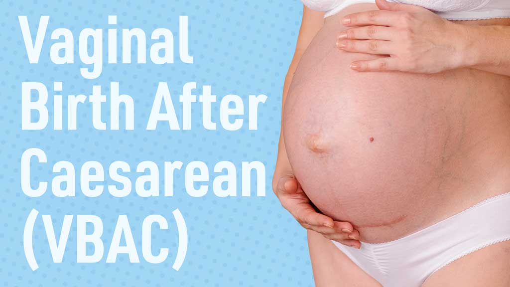 Vaginal Birth After Caesarean VBAC Ausmed Vaginal Birth After Caesarean VBAC Ausmed