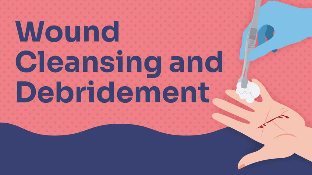 Wound Cleansing Debridement Skills Wound Cleansing Debridement Skills